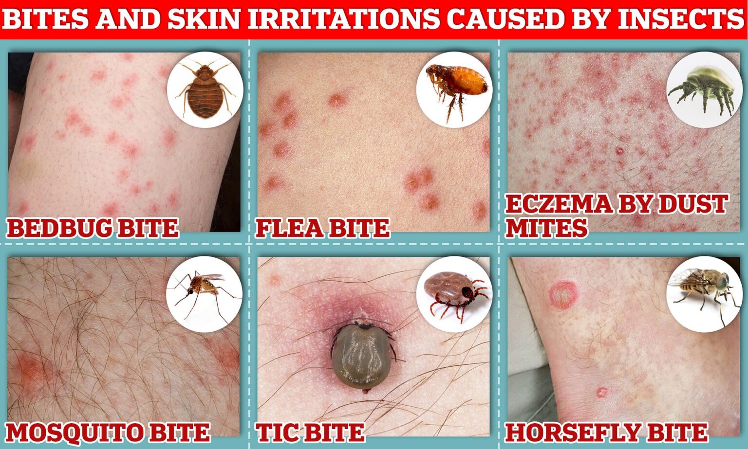 Beware Of Bed Bug Bites How They Can Aggravate Mite Infestations Huffington News