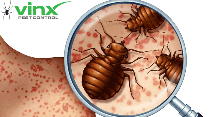 Pesky Pests How To Identify And Treat Bed Bug Bites On The Scalp Huffington News
